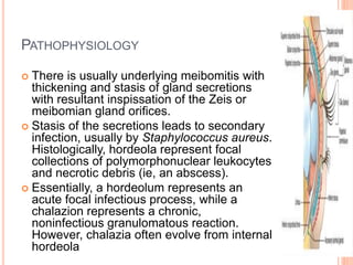 Pathology of eye lids and adnexa | PPTX