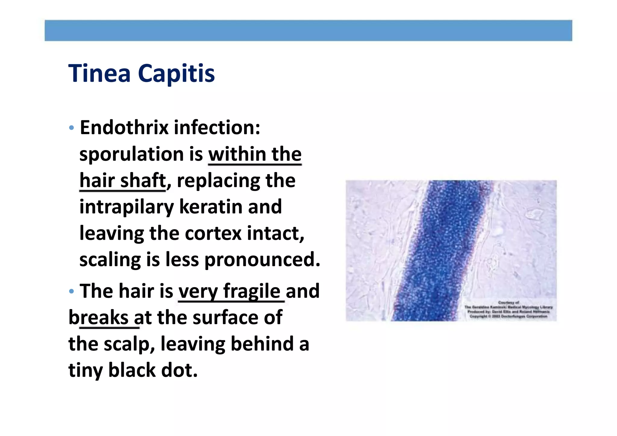 Pathology of fungal infection | PPTX