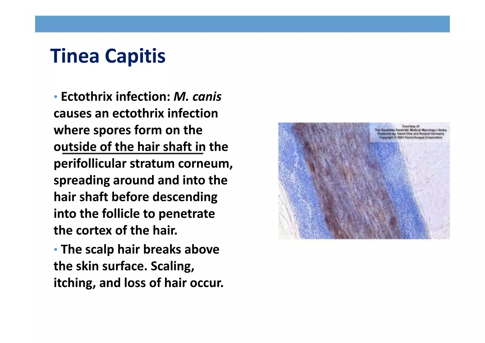 Pathology of fungal infection | PPTX