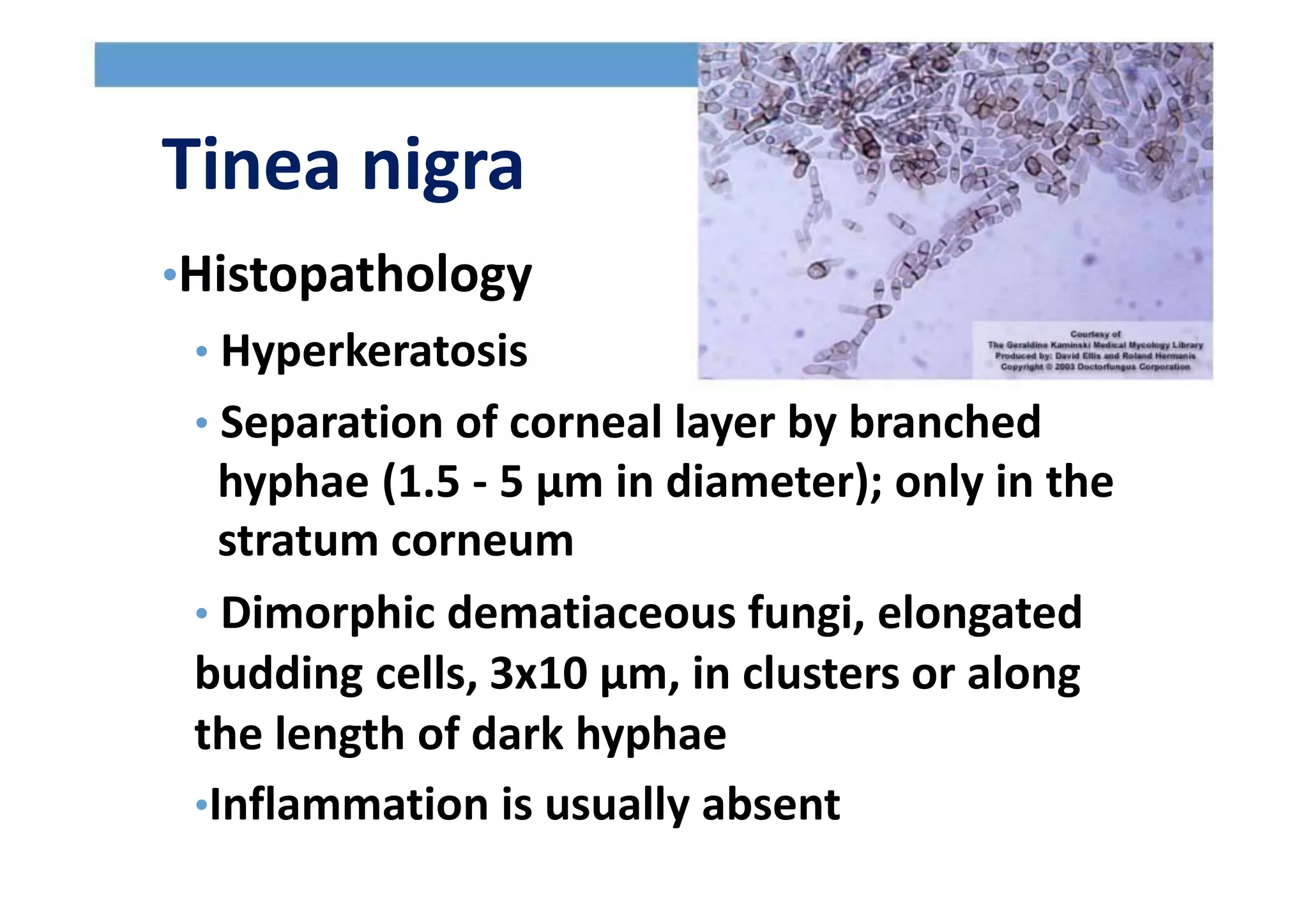 Pathology of fungal infection | PPTX