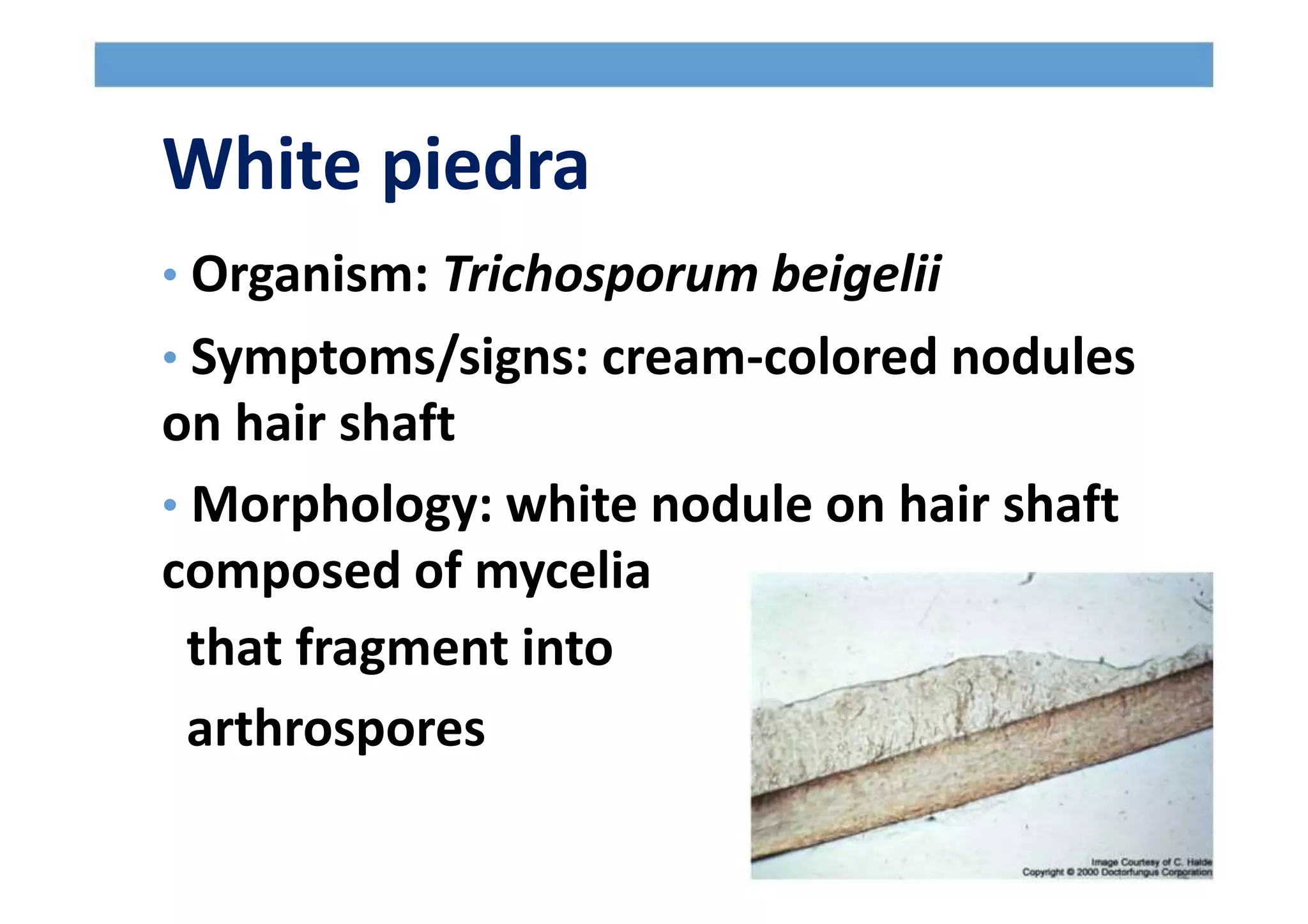 Pathology of fungal infection | PPTX