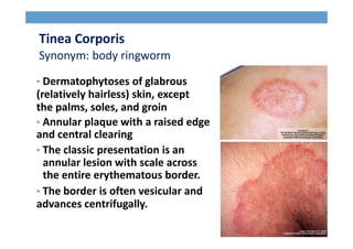 Pathology of fungal infection | PPTX