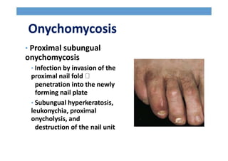 Pathology of fungal infection | PPTX