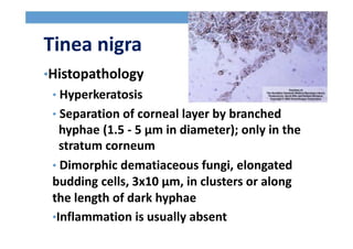 Pathology of fungal infection | PPTX