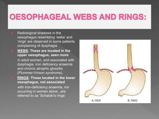 PATHOLOGY OF GASTROINTESTINAL TRACT( Oesophagus).pptx