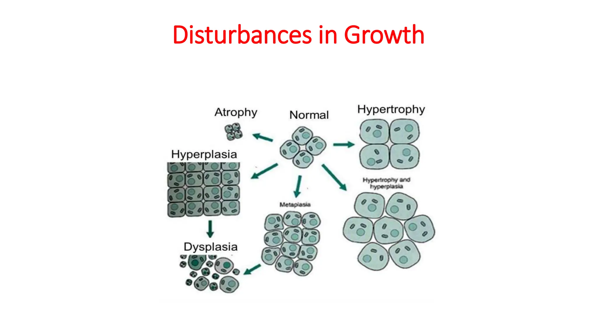 Pathology_of_Growth_cellulardisturbances.pptx
