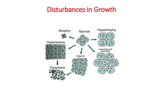 Pathology_of_Growth_cellulardisturbances.pptx