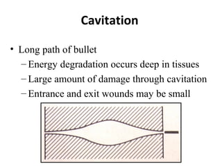 Pathology of gunshot injury to the lower extremity by dr.amah