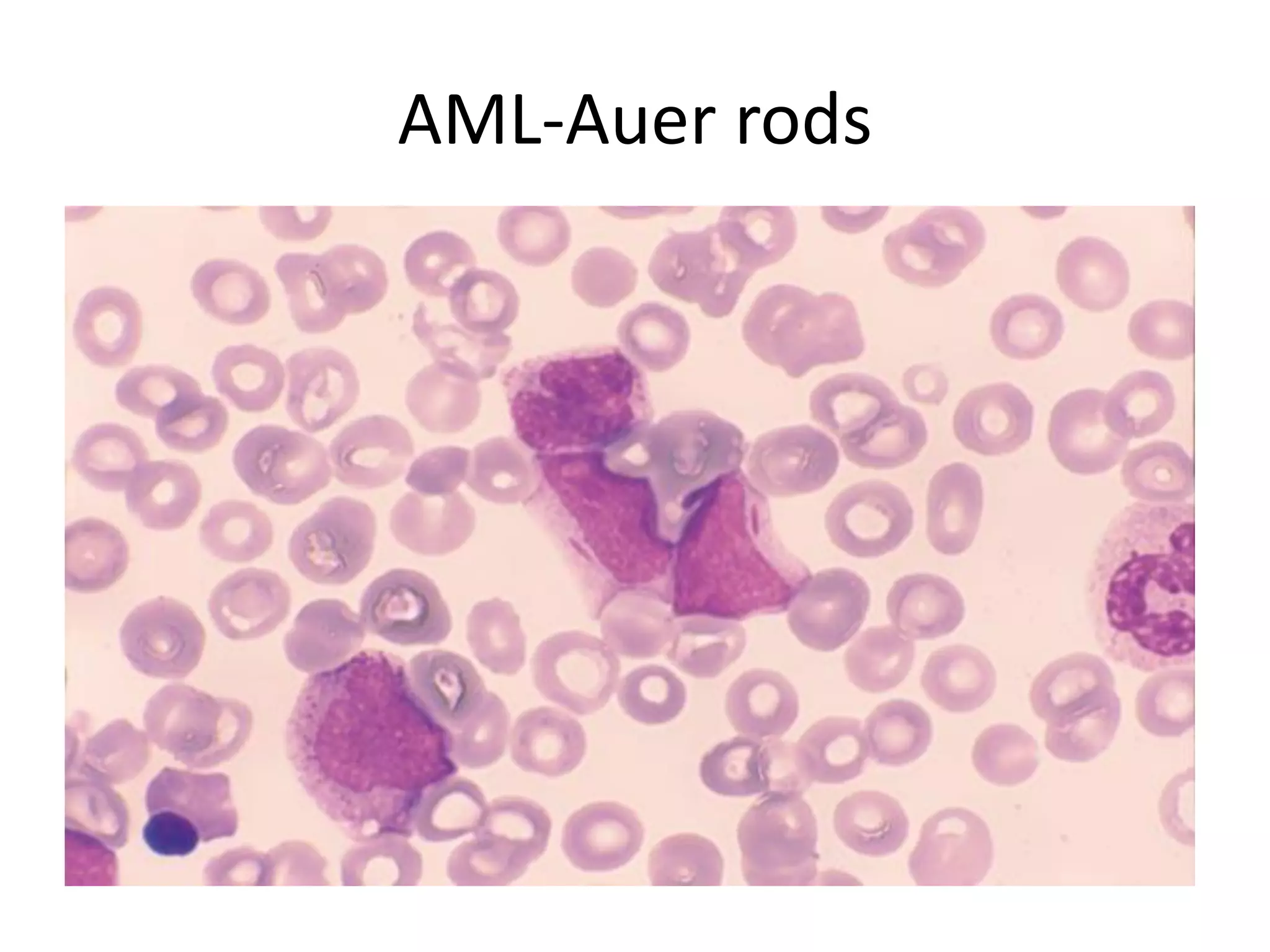 Pathology of hematolymphoid system | PDF