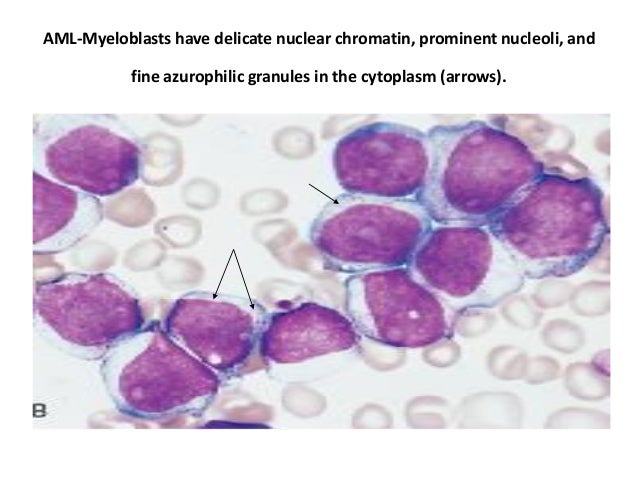 Pathology of hematolymphoid system