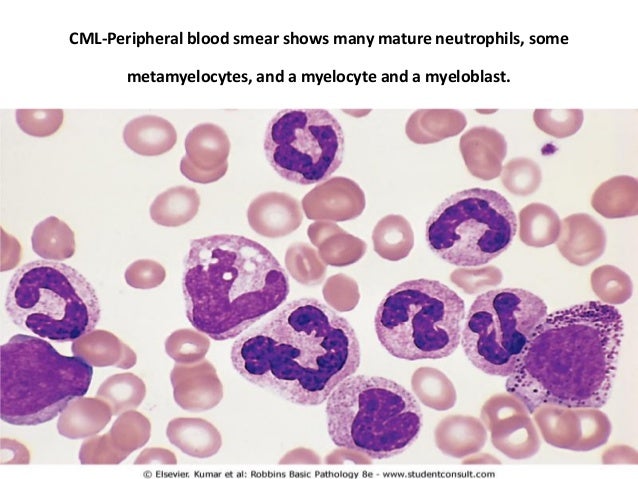Pathology of hematolymphoid system