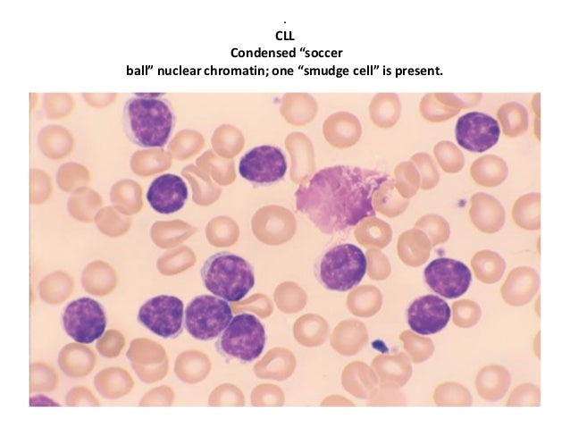 Pathology of hematolymphoid system