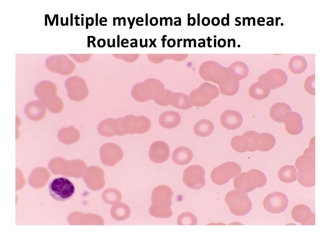 Pathology of hematolymphoid system