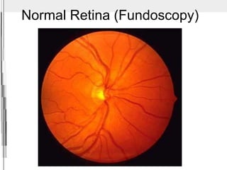 Pathology of hypertention.pptx
