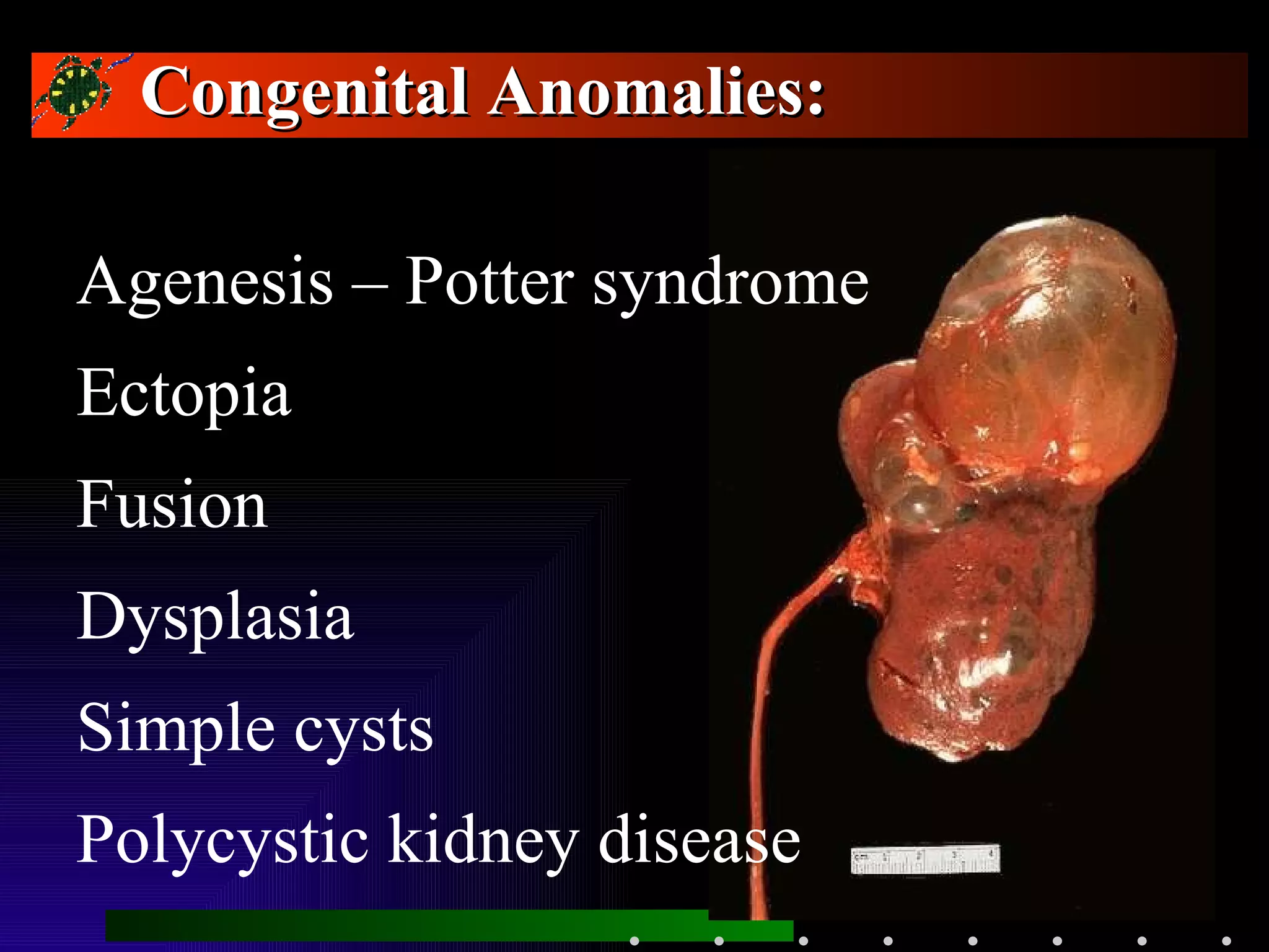Pathology Of Kidney | PPT
