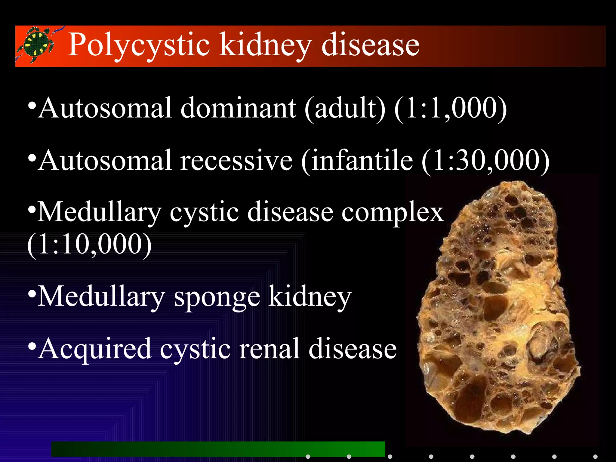 Pathology Of Kidney | PPT