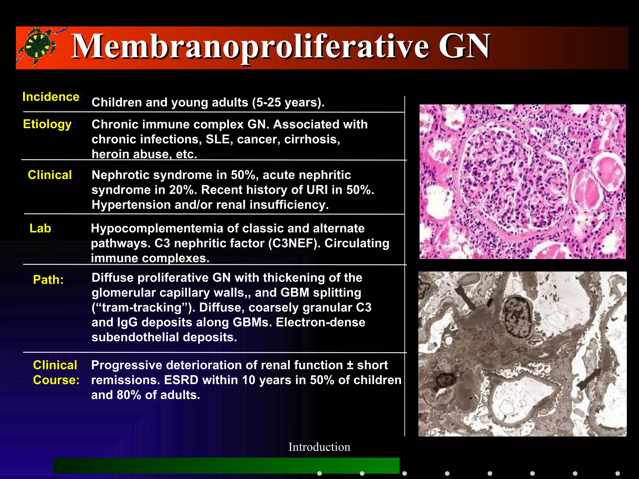 Pathology Of Kidney | PPT