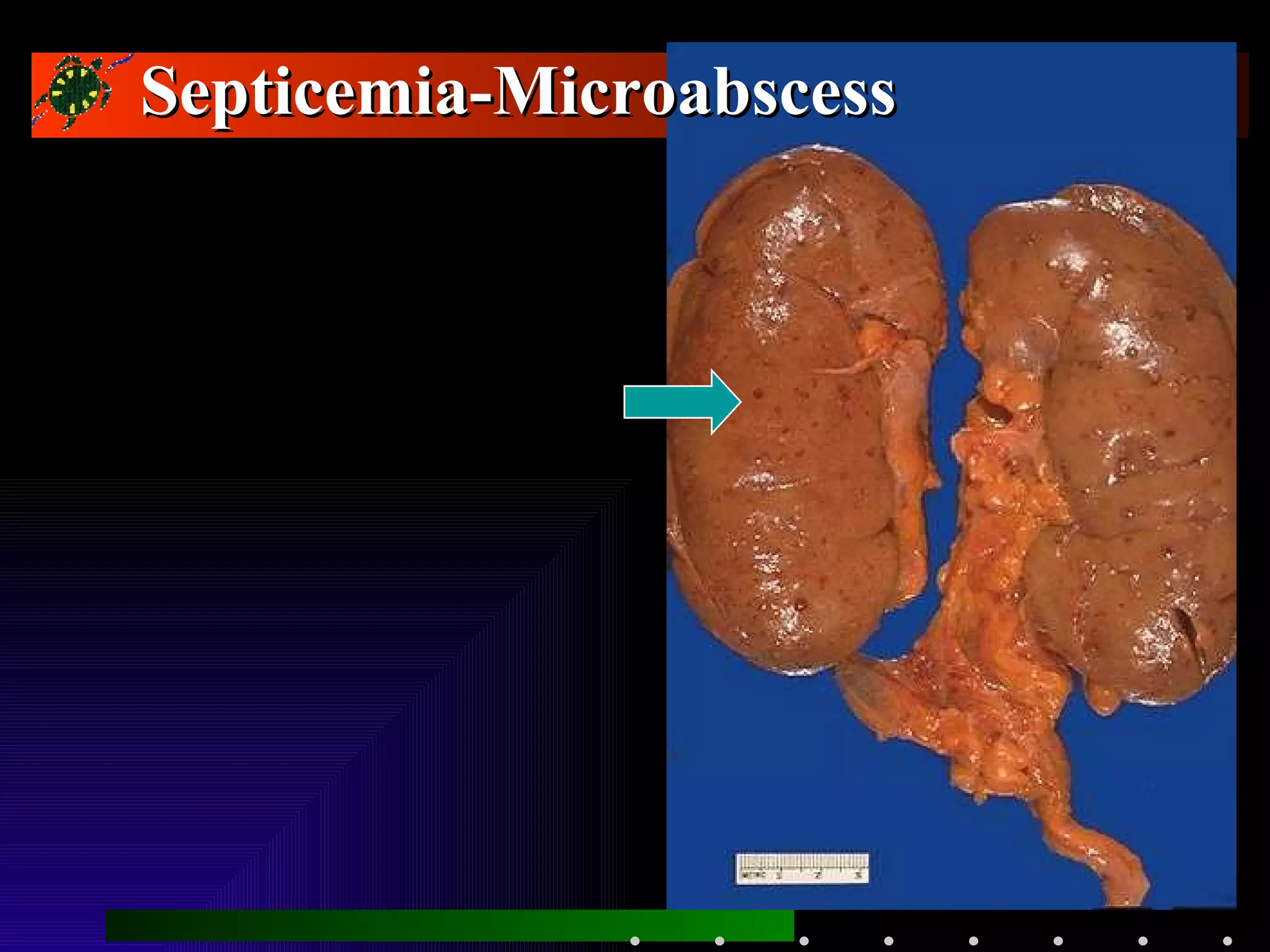 Pathology Of Kidney | PPT