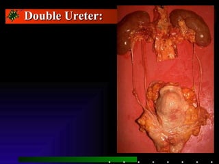 Pathology Of Kidney | PPT