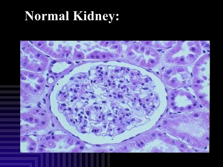 Pathology Of Kidney