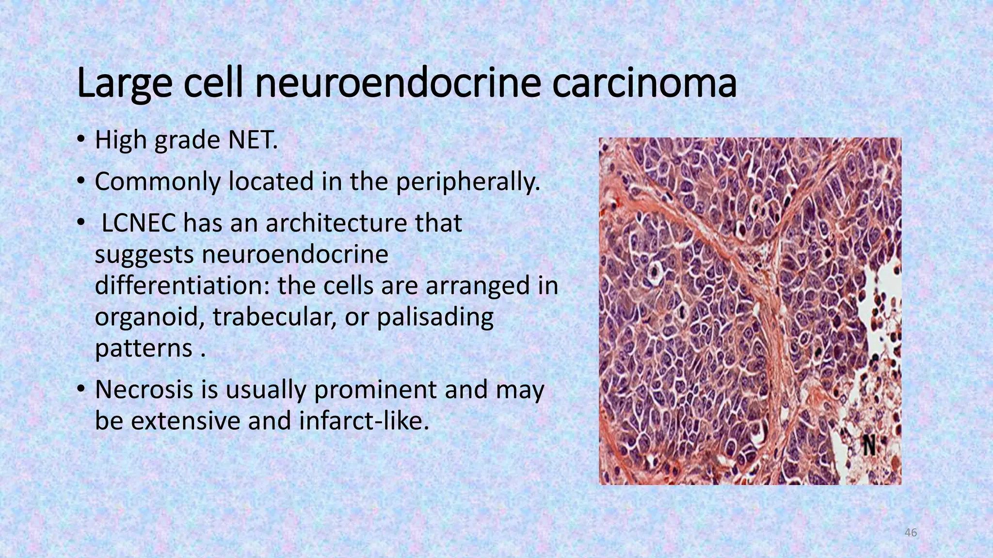 Pathology of Lung Neoplasm seminar Y12HMC.pptx