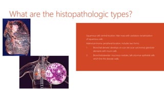 Pathology of lung with Pathology of Lung Neoplasms.pdf