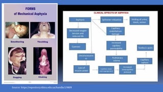 Pathology of mechanical asphyxia - a brief overview | PPTX