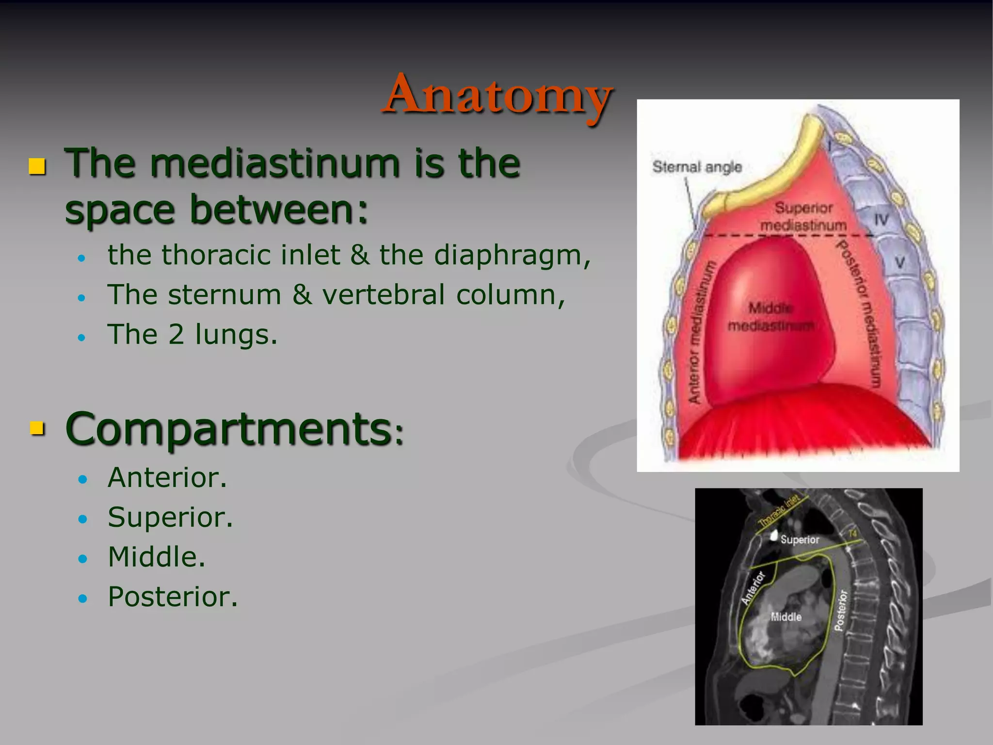 Pathology of mediastinal masses | PDF