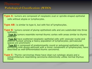 Pathology of mediastinal masses | PDF