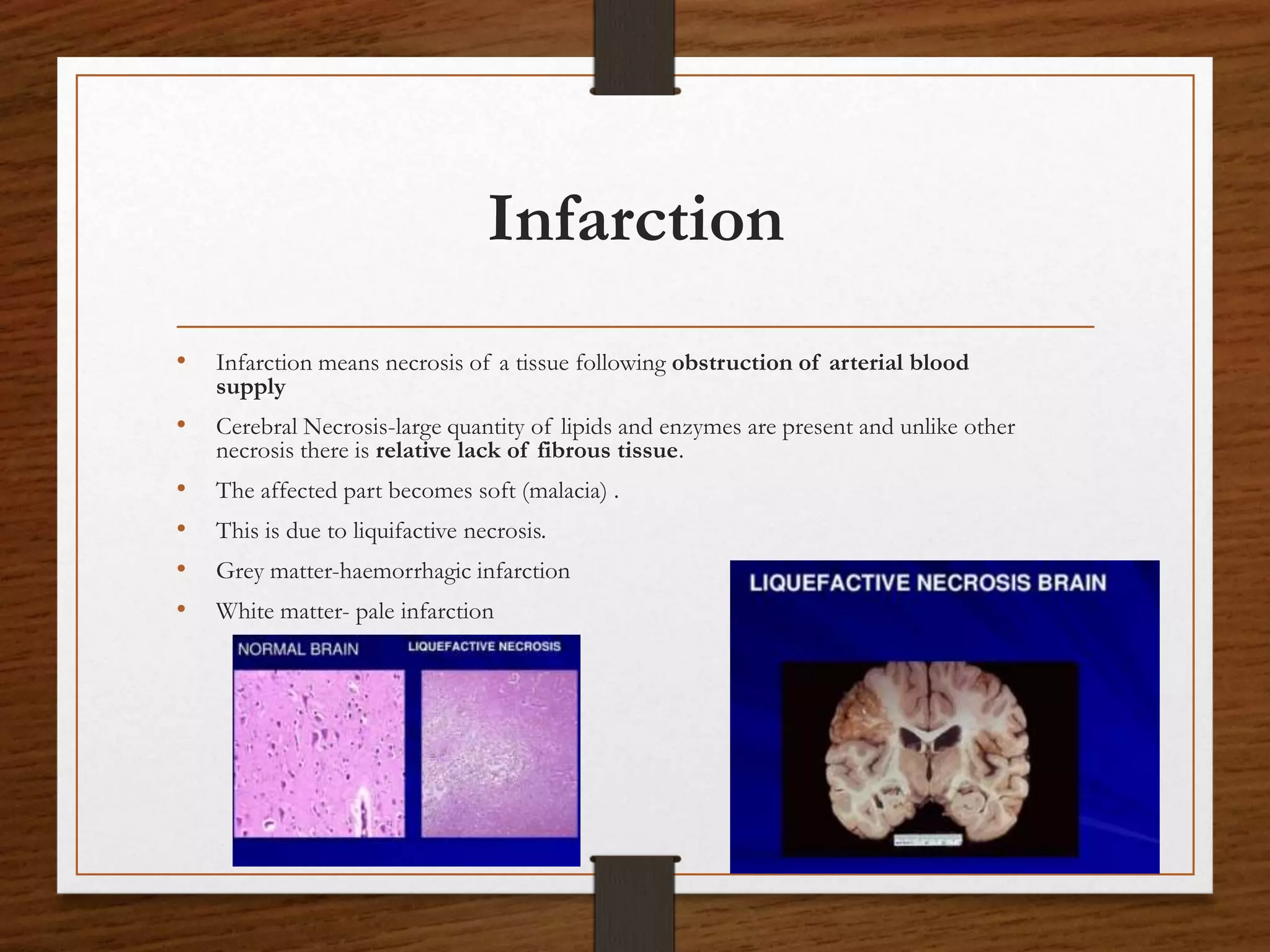 Pathology of nervous system | PPTX