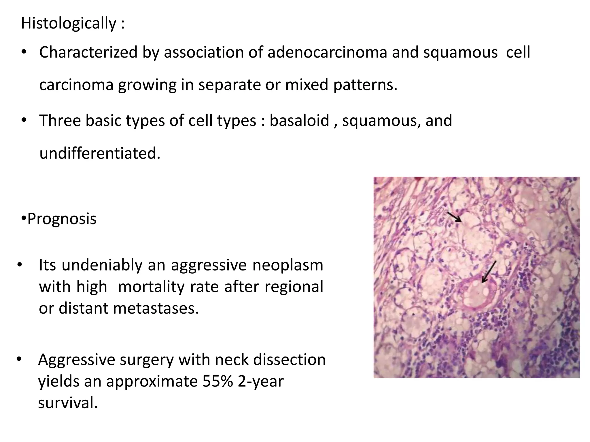 Pathology of oral cancer | PPTX