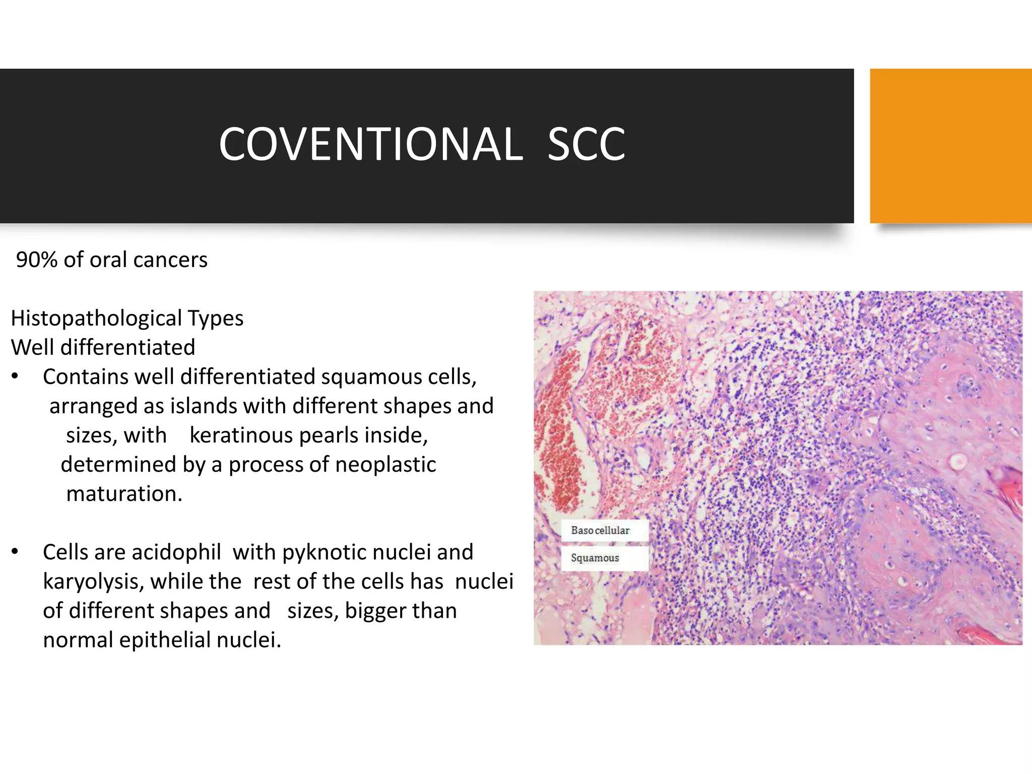 Pathology of oral cancer | PPTX