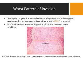 Pathology of oral cancer | PPTX