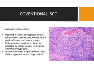 Pathology of oral cancer | PPTX