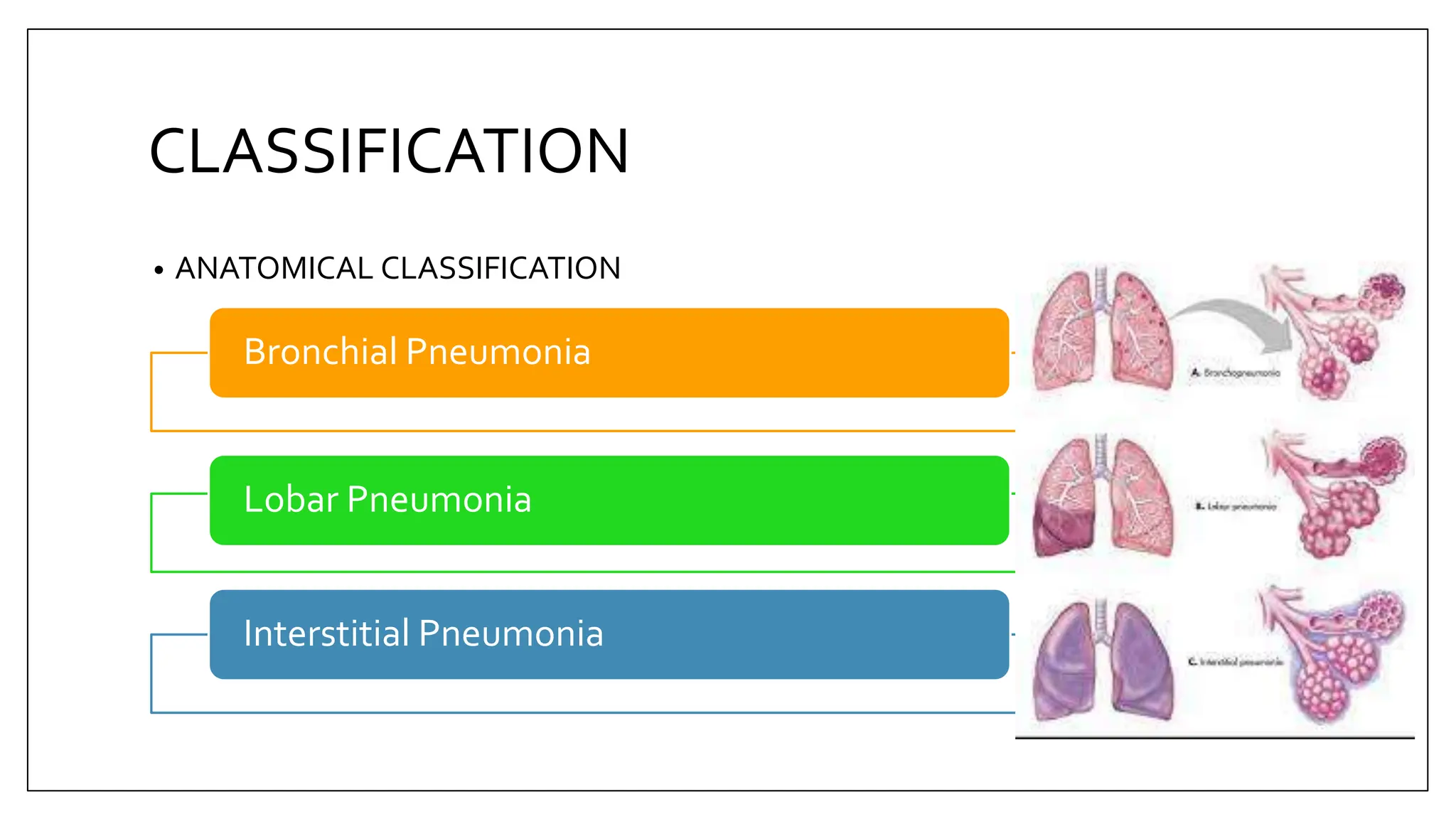 PATHOLOGY OF PENUMONIA.pptx