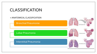 PATHOLOGY OF PENUMONIA.pptx