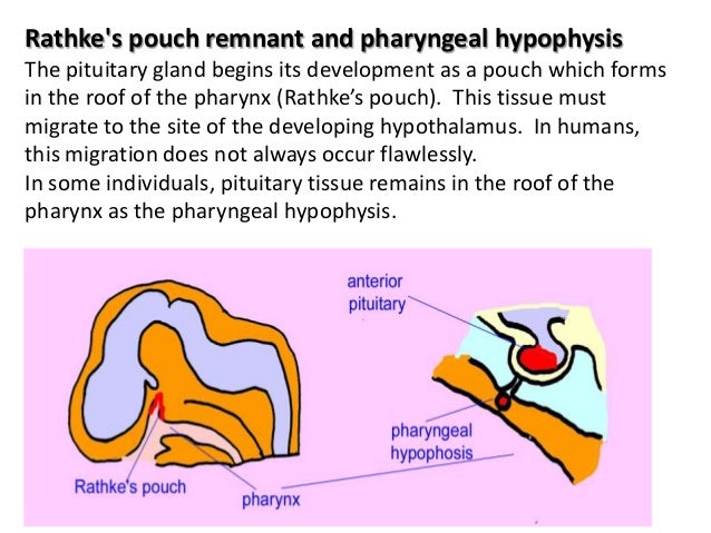 Pathology of pharynx