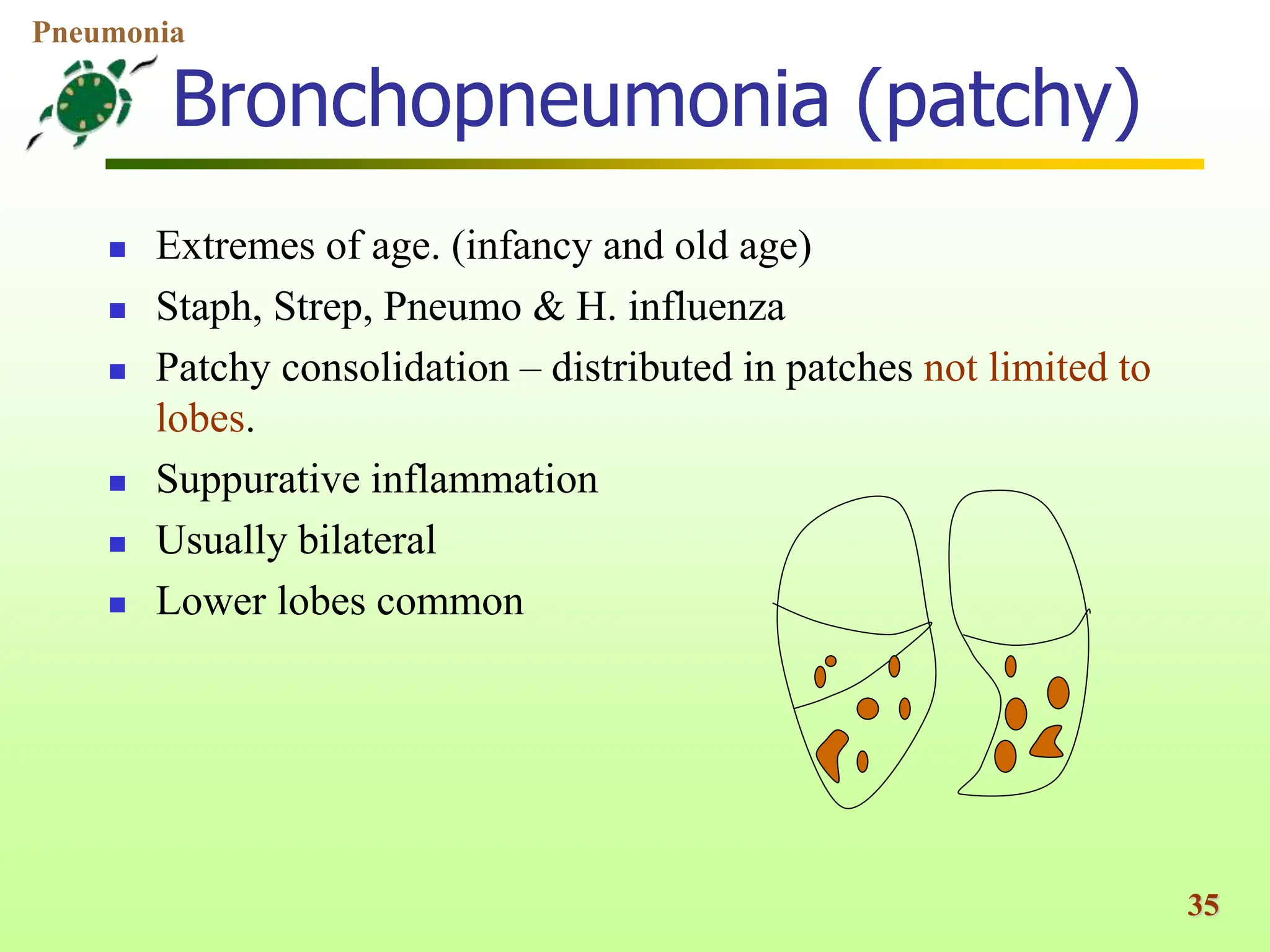 Pathology of Pneumonia POWERPOINT PRESENTATION | PPT