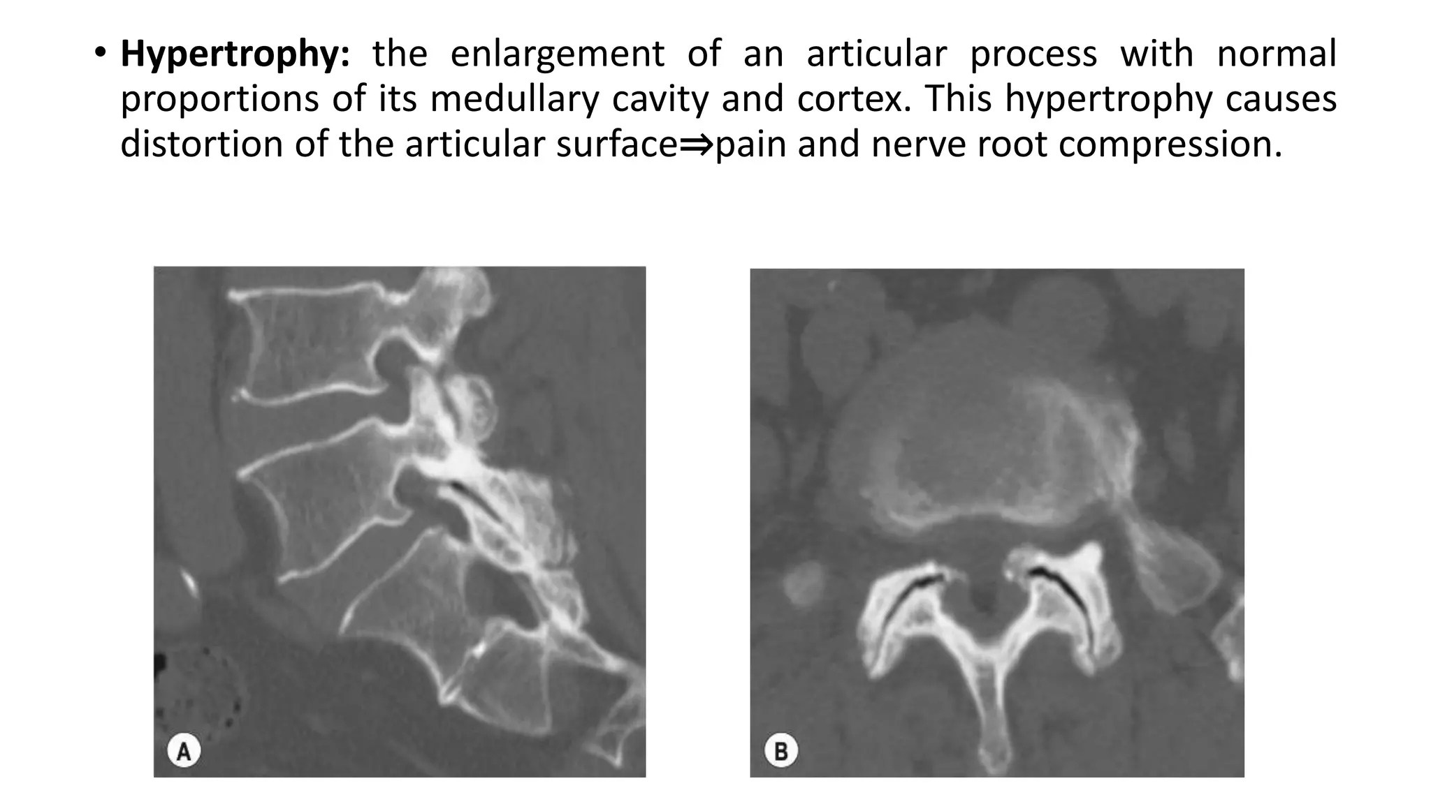 Pathology of posterior elements.pptx