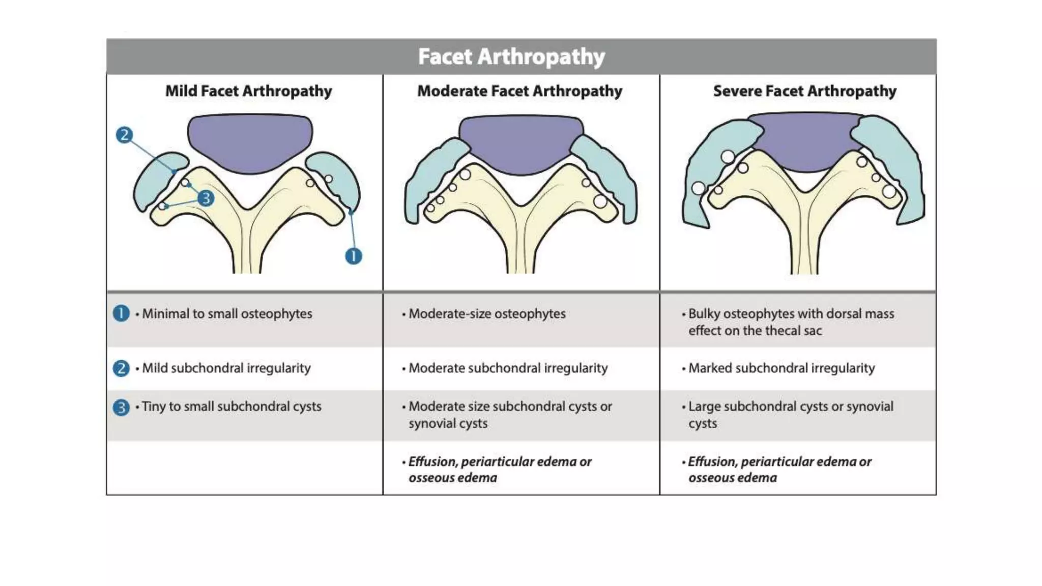 Pathology of posterior elements.pptx