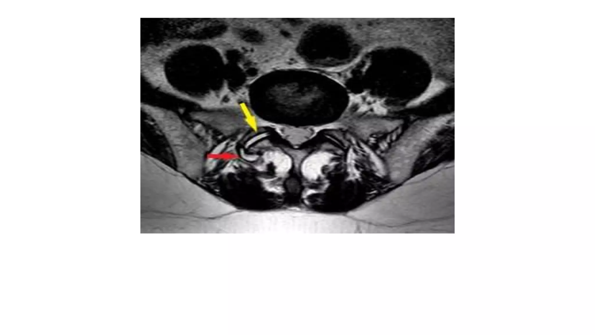 Pathology of posterior elements.pptx