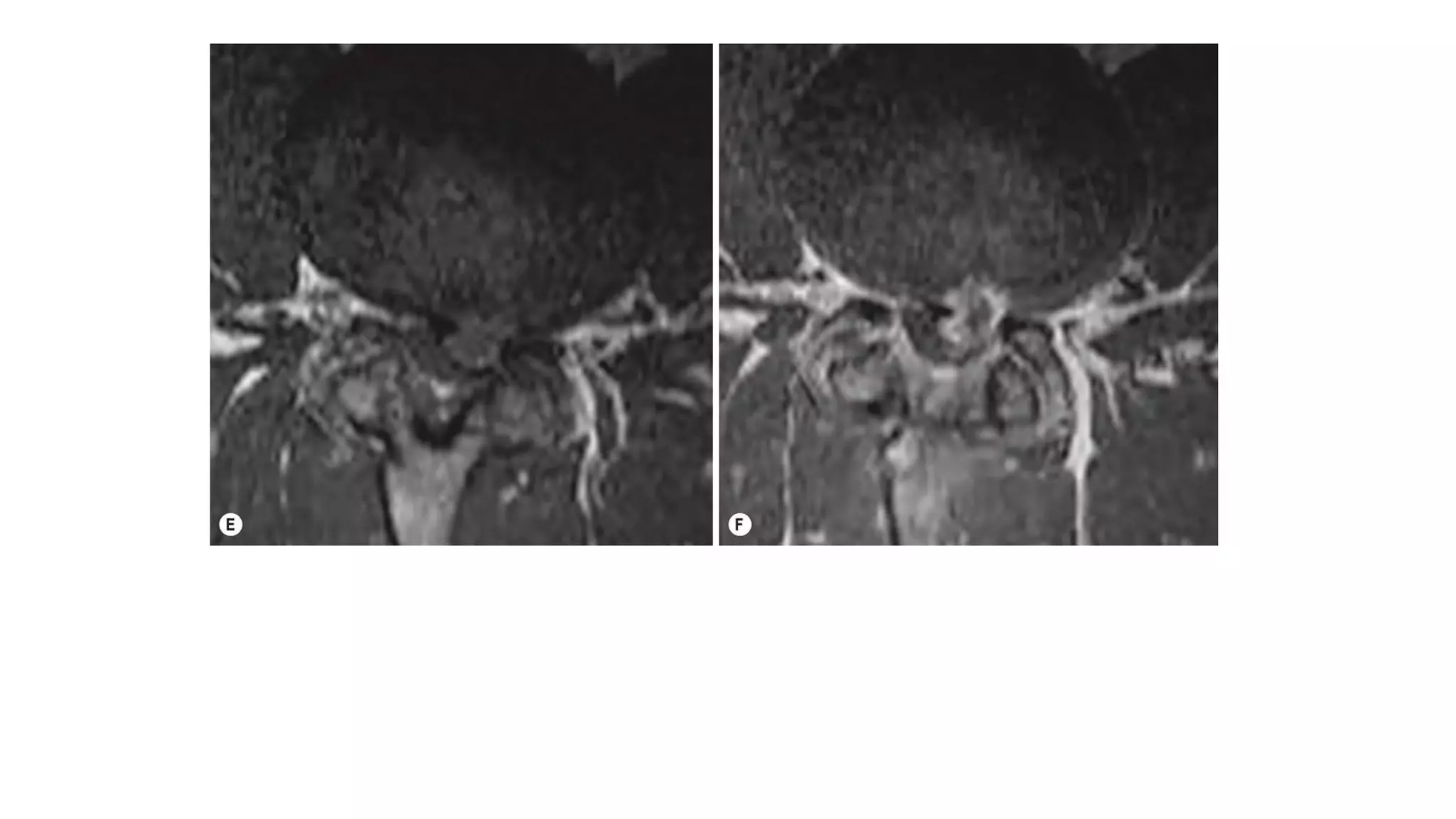 Pathology of posterior elements.pptx