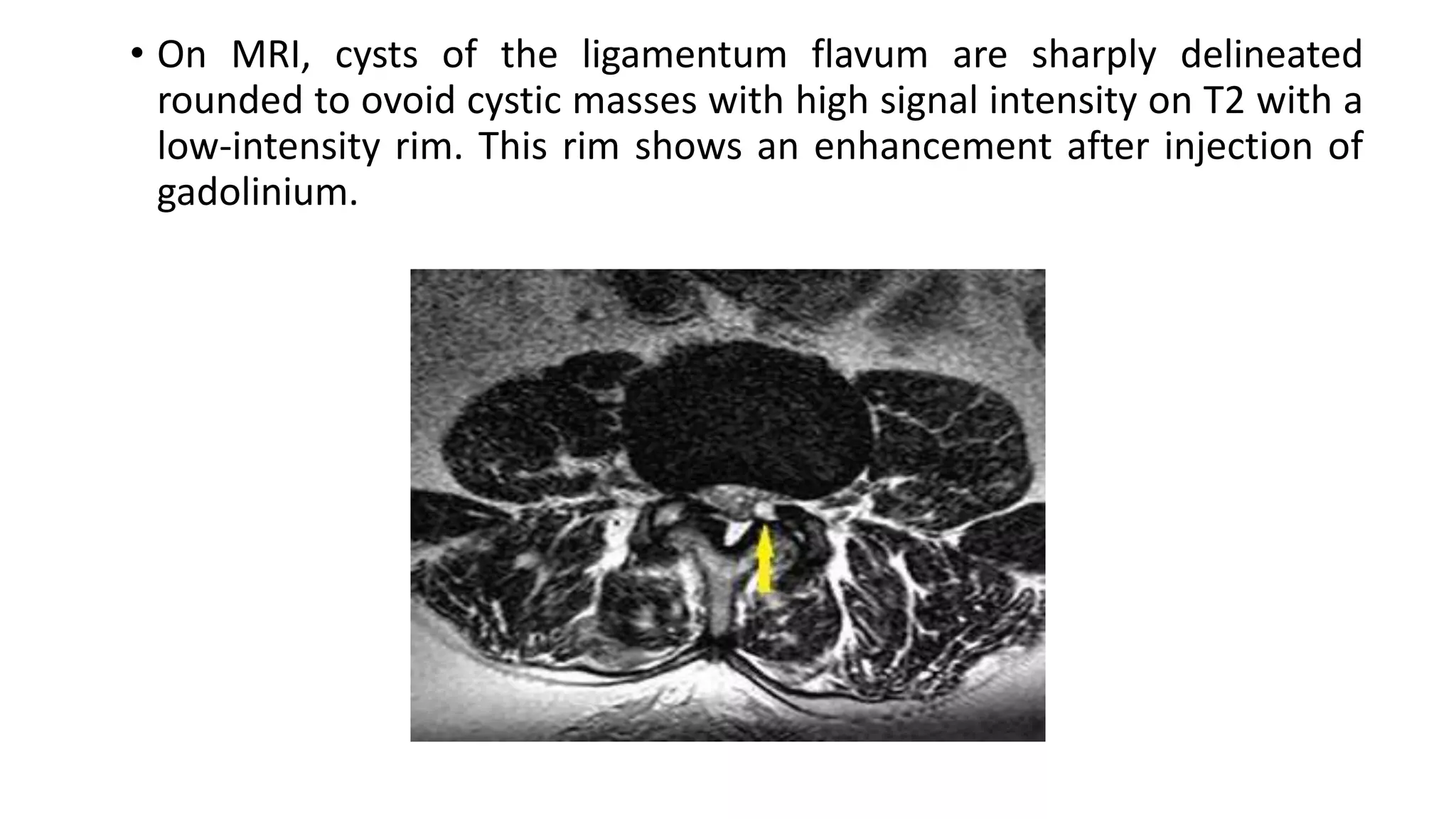 Pathology of posterior elements.pptx