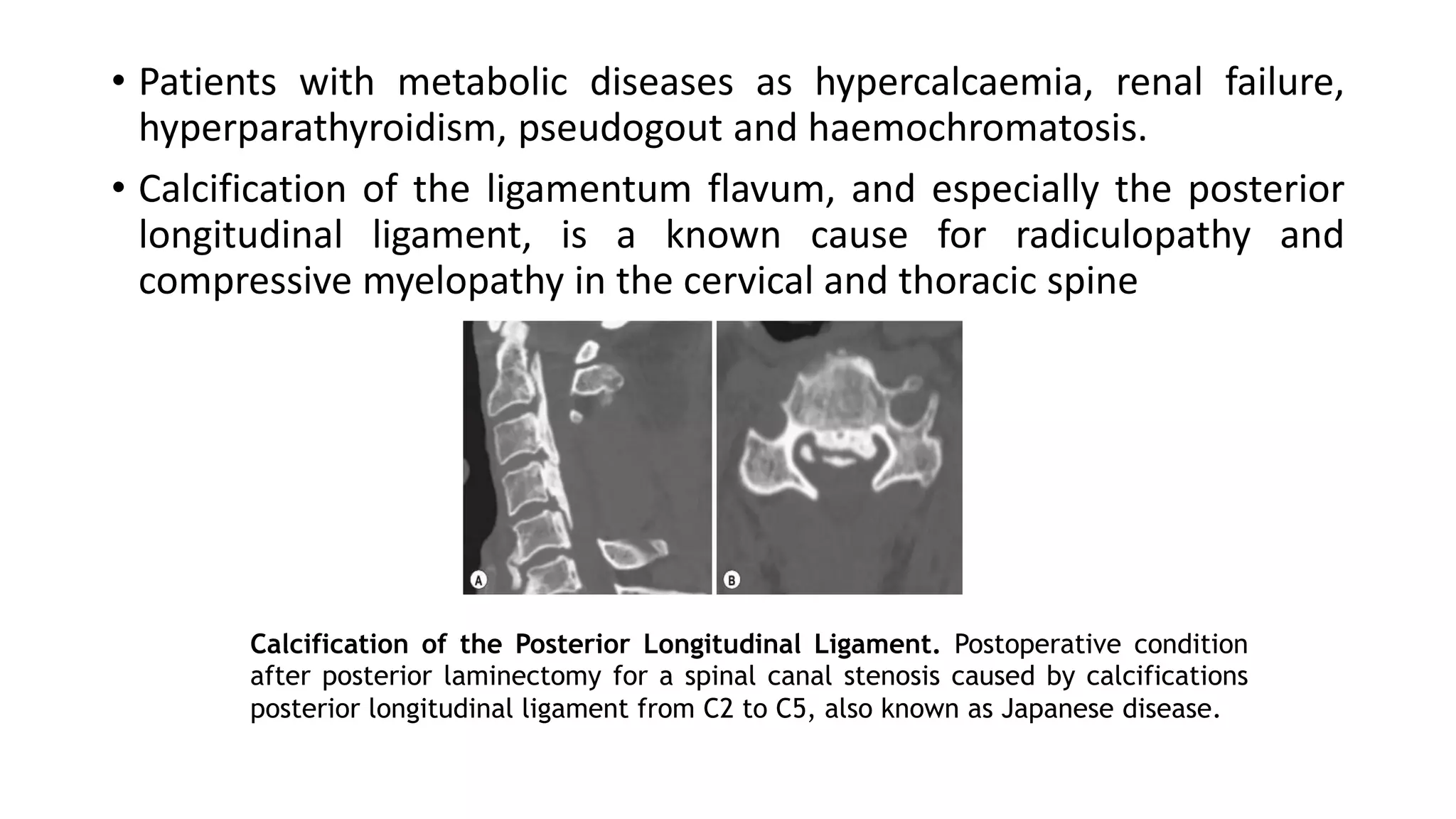 Pathology of posterior elements.pptx