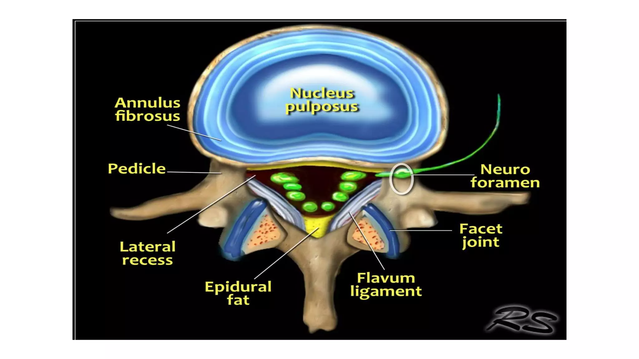 Pathology of posterior elements.pptx