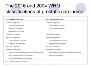 Pathology of prostate | PPT