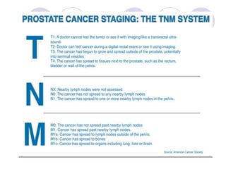 Pathology of prostate | PPT