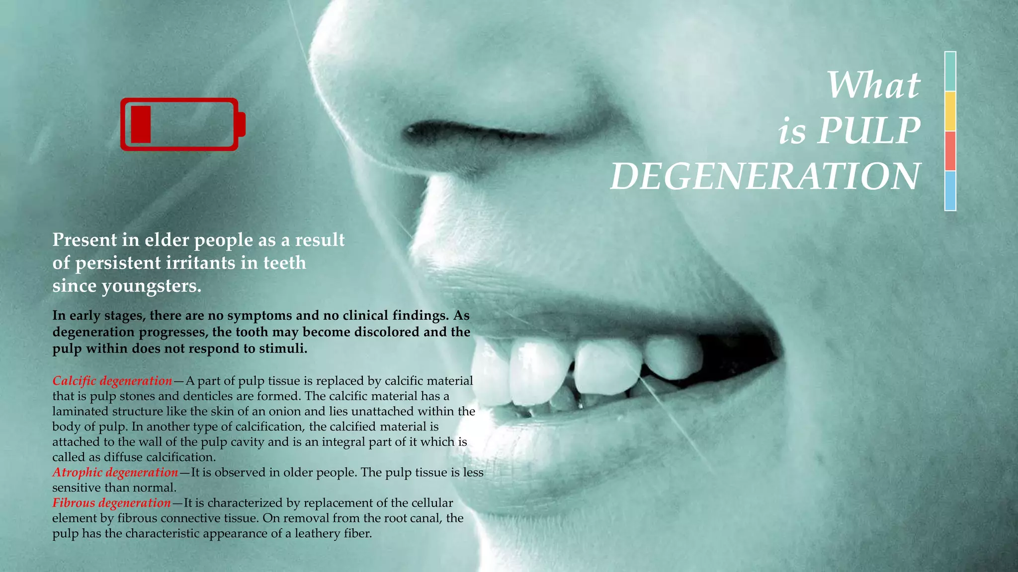 Pathology of pulp and its sequels | PPTX