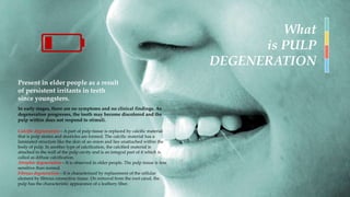 Pathology of pulp and its sequels | PPTX