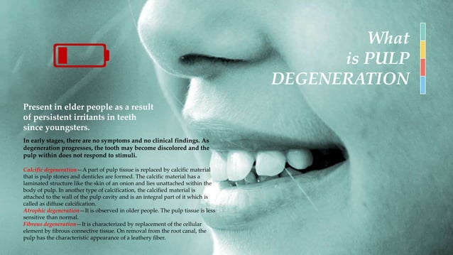 Pathology of pulp and its sequels | PPTX | Dental Health | Diseases and ...